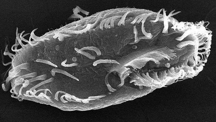 Discovering Patterns in a Scrambled Genome - IMA