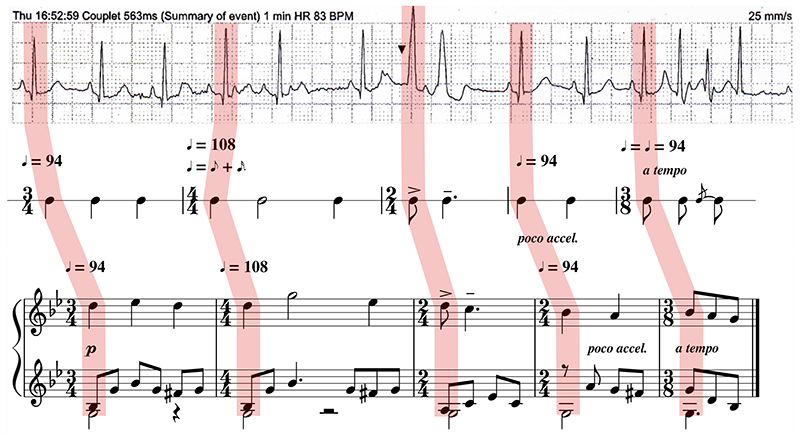Listening With a Digital Ear: How Maths Is Changing the Way We ...