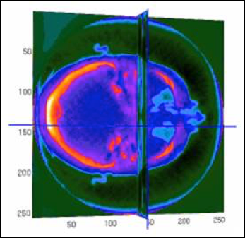 Saving Lives With Mathematics: Removing Landmines and Tumours - IMA