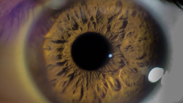 Mathematics in the Management of Eye Care - IMA